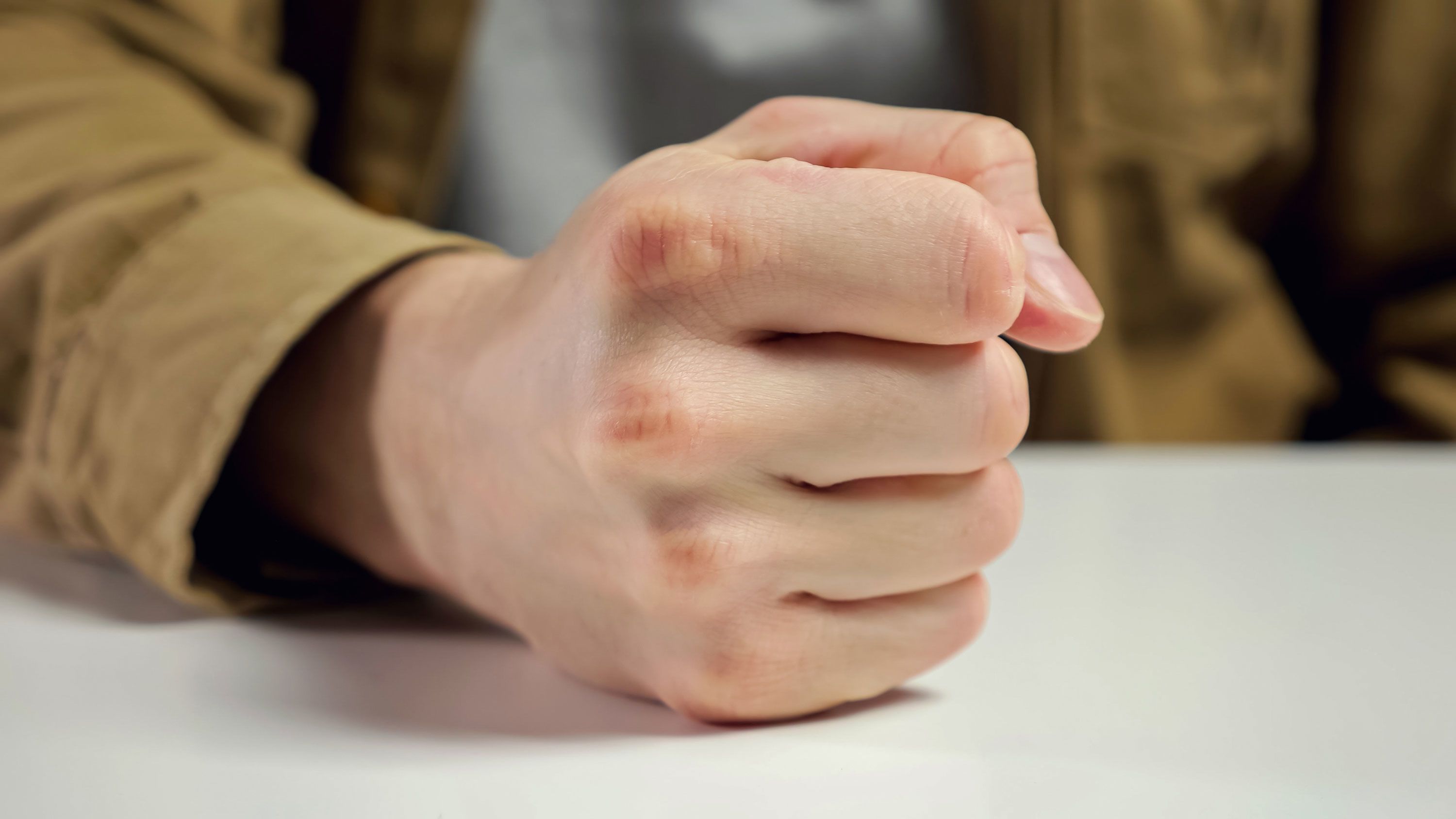 Anger can harm your blood vessel function, study shows | Houston Style ...